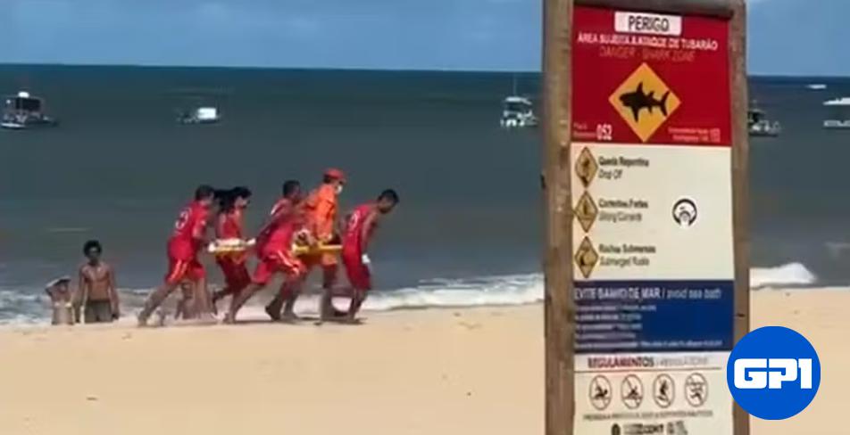 Menino de 11 anos tem perna amputada após ataque de tubarão em praia do ...